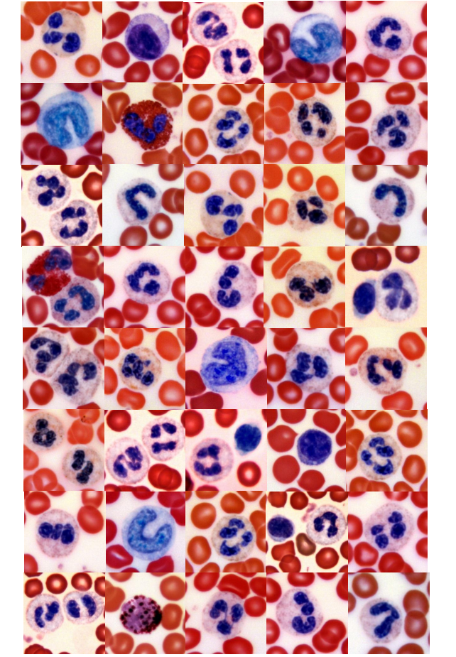 Solved Lab Act 2: WBC differential counts - Lab report A. | Chegg.com