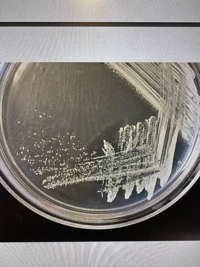 1. Record the colony counts from the TSY inoculated | Chegg.com