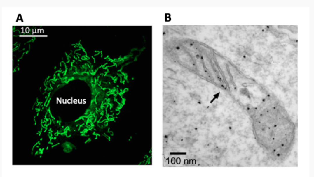 Solved The micrographs shown below correspond to the GFP | Chegg.com