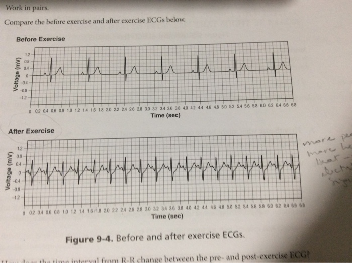 Solved Compare the before exercise and after exercise ECGs | Chegg.com