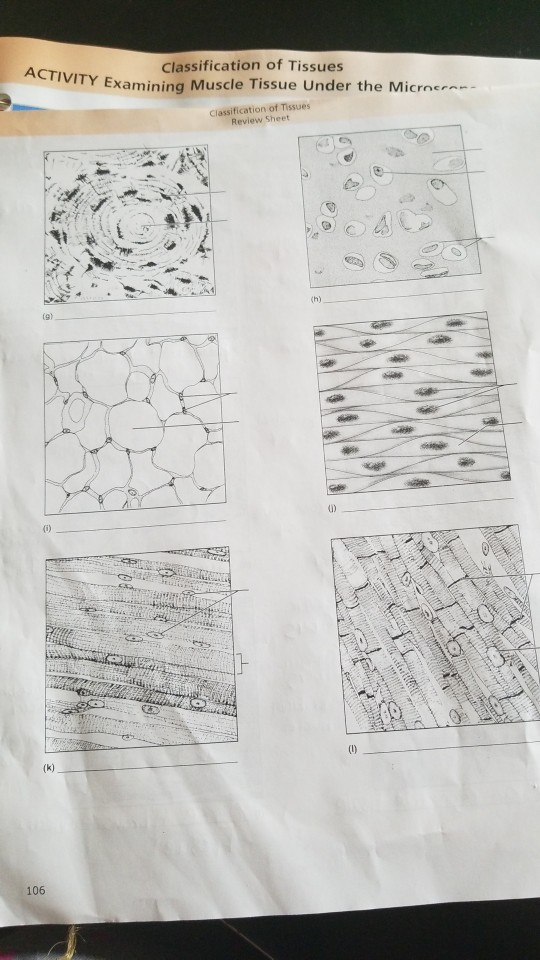 Solved label the tissue type illustrated here and identify | Chegg.com