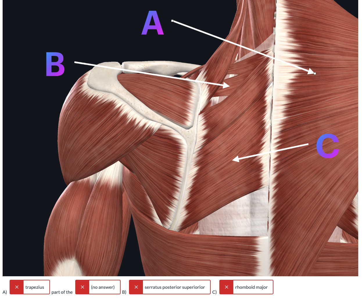 Solved A) ___part of the ___ ﻿B) ___ ﻿C)___ | Chegg.com