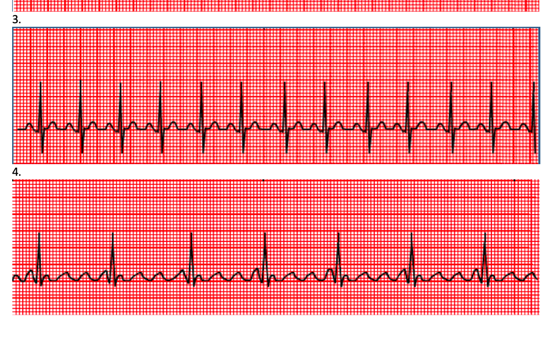 Solved Identify each rhythm and try to identify the | Chegg.com