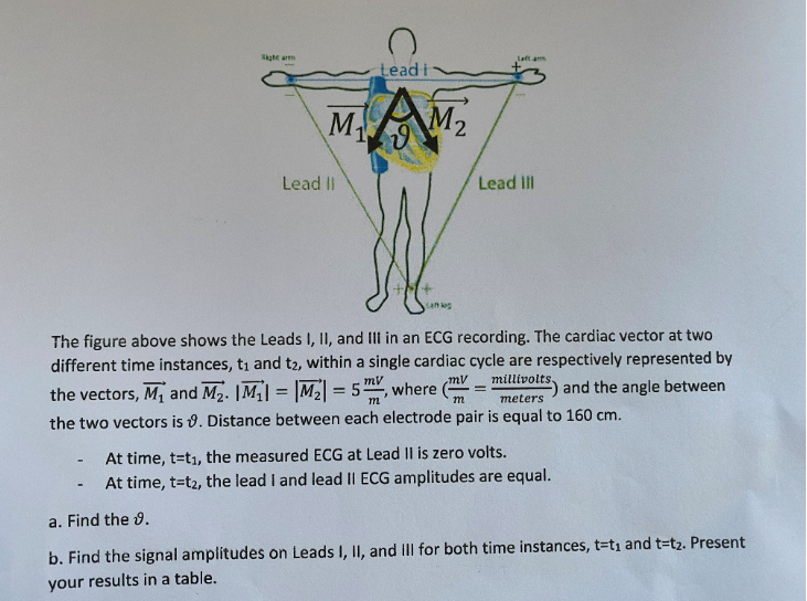 Solved tead i M AM Lead 1 Lead III og The figure above shows | Chegg.com
