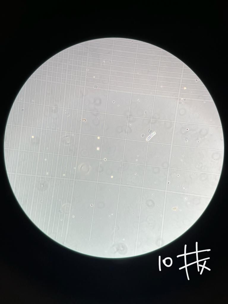Solved Counting trypsinized cells (with 5% & 10% ethanol) on | Chegg.com