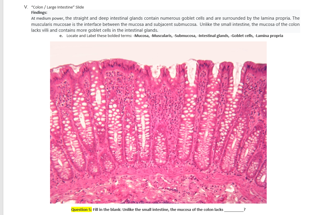 Solved At high power, the gastric pits and glands of the | Chegg.com