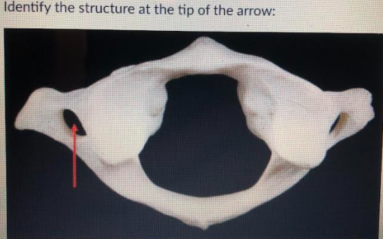 Solved Identify the structure at the tip of the arrow: YA | Chegg.com