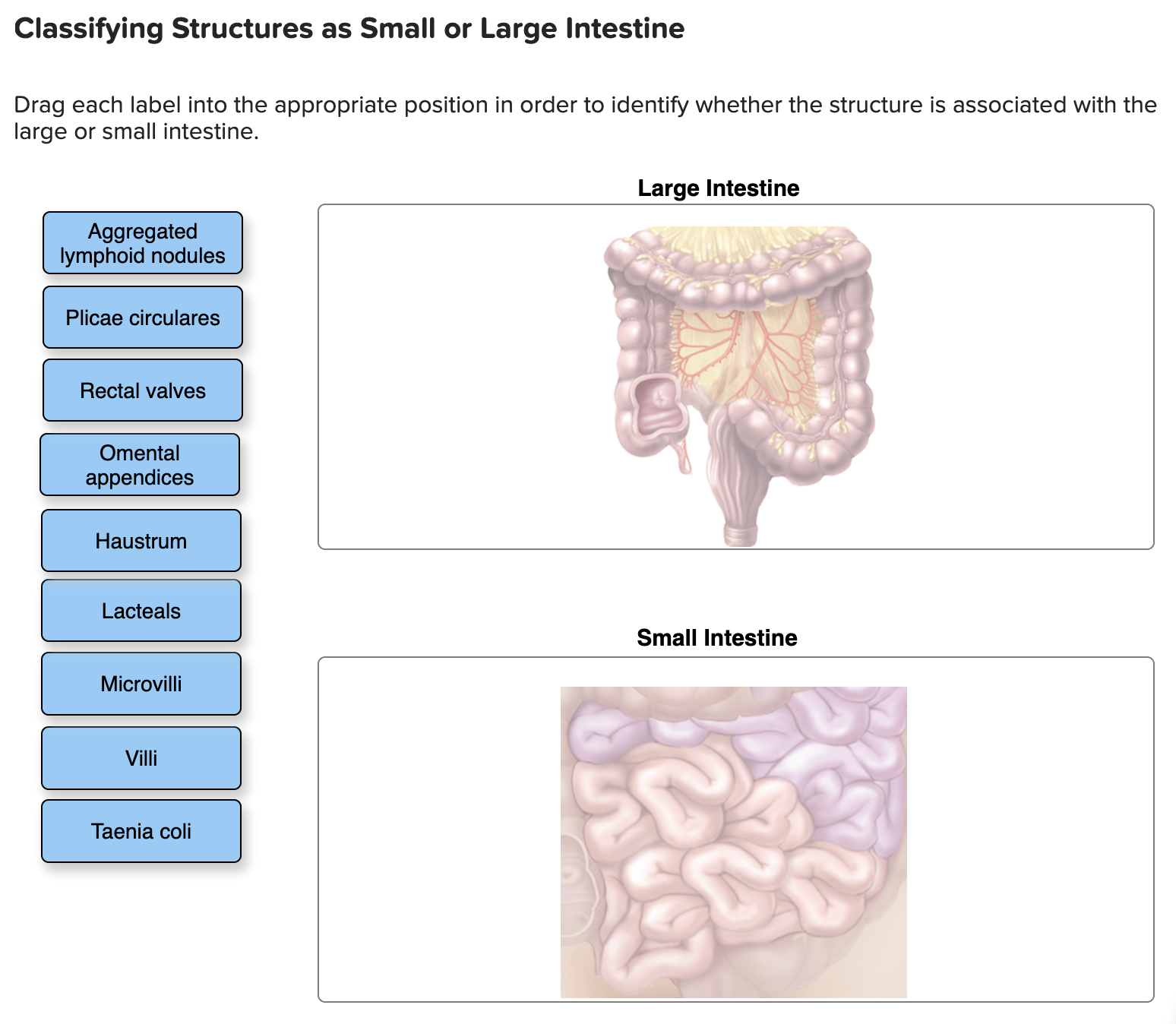 Solved Classifying Structures as Small or Large | Chegg.com
