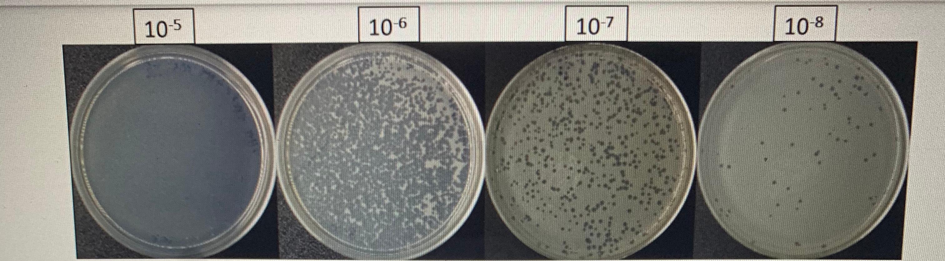Solved Question 2) A student wanted to obtain a phage titer | Chegg.com