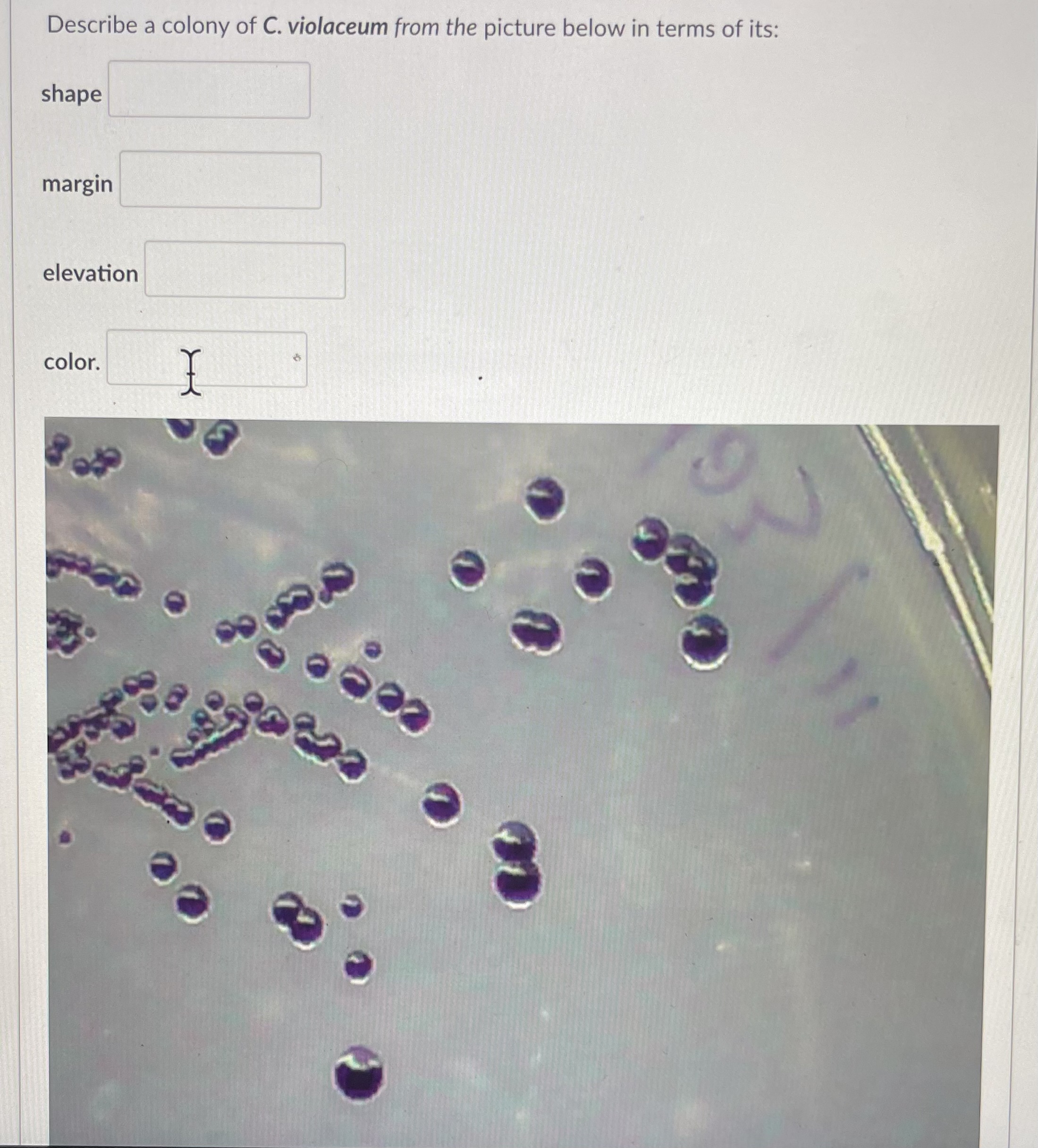 Solved Describe a colony of C. ﻿violaceum from the picture | Chegg.com
