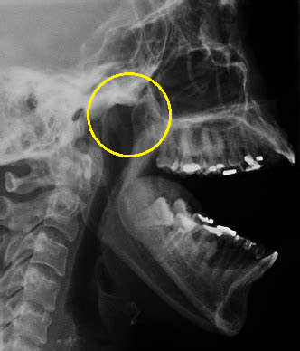 Solved 1. This is a luxation or dislocation of the | Chegg.com