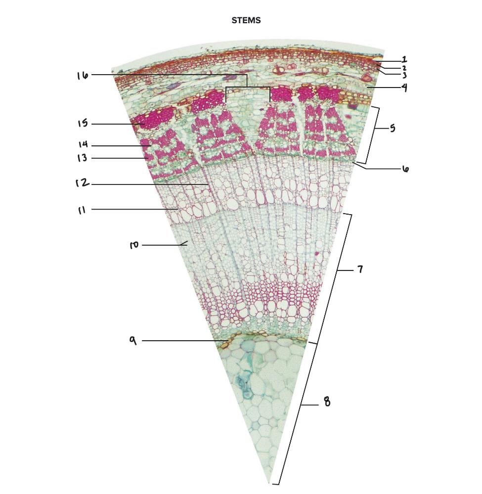 Solved Label the following on the drawing please:l BROAD | Chegg.com