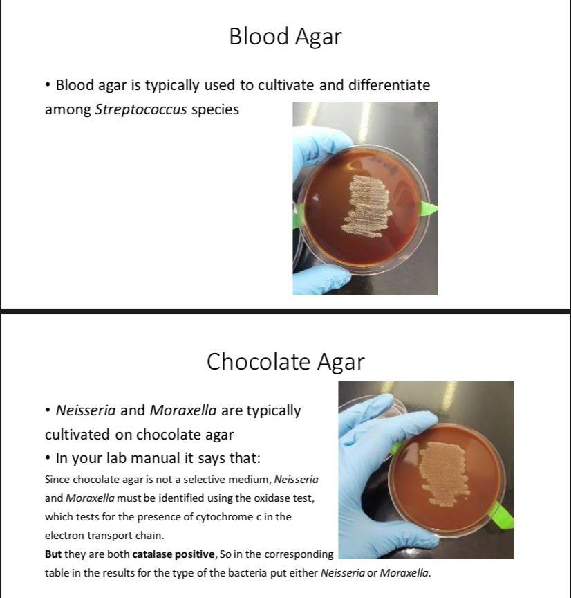 Solved Blood Agar • Blood agar is typically used to | Chegg.com