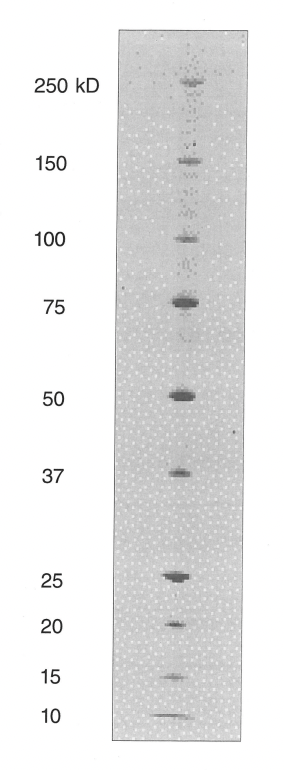 Figure 1: The SDS-Page after destaining process. Left | Chegg.com