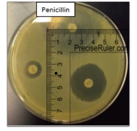 Three antibiotics discs, penicillin, streptomycin and | Chegg.com