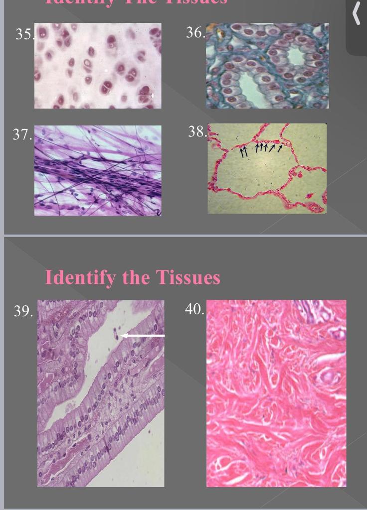 Solved Identify The Tissues 2. 3. Identify The Tissues 16. | Chegg.com
