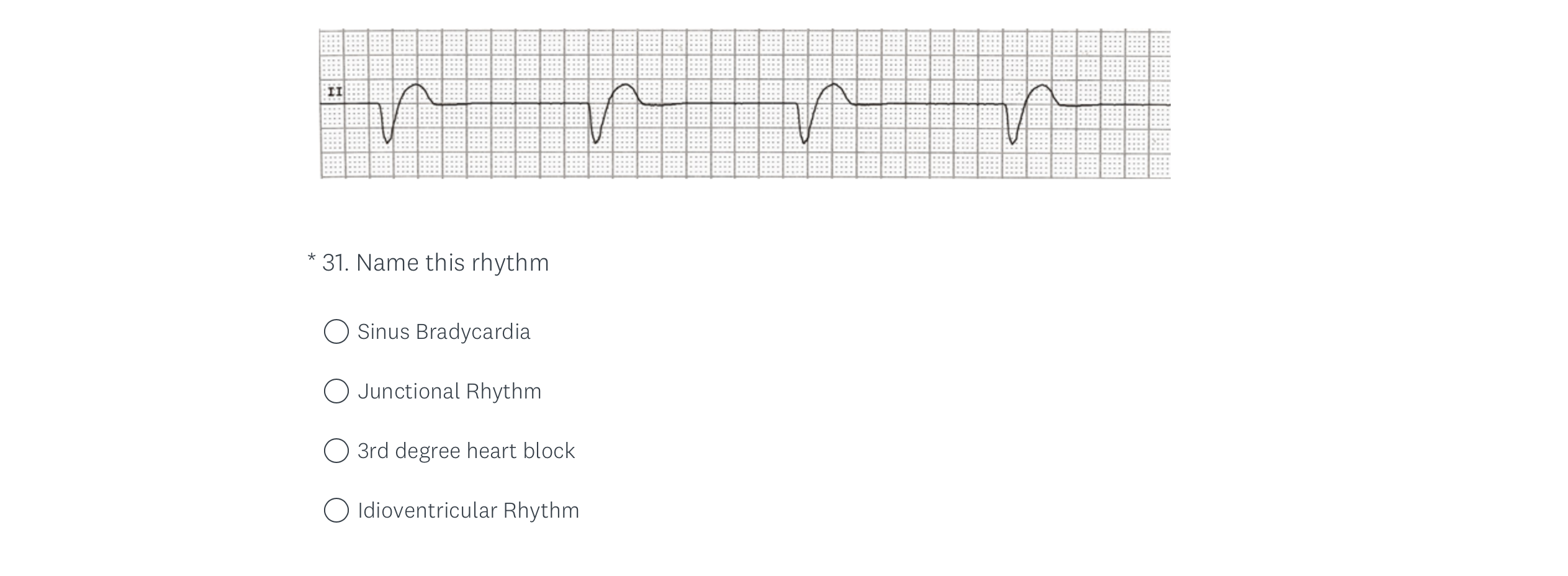 Solved * 31 . Name this rhythm Sinus Bradycardia Junctional | Chegg.com