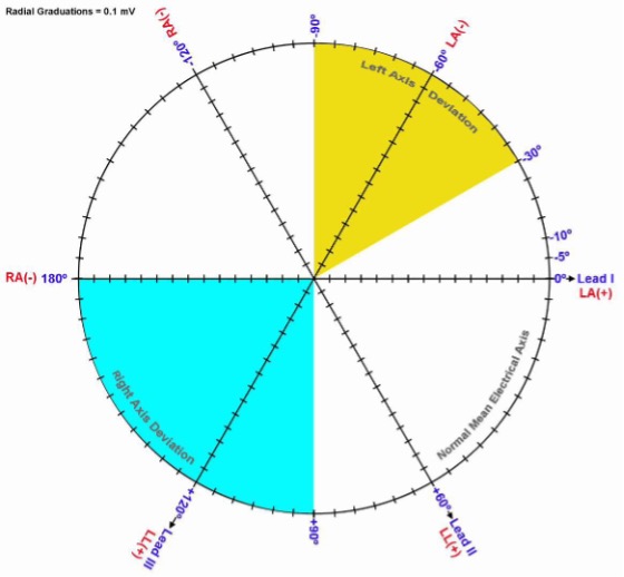 One way to approximate the mean electrical axis in | Chegg.com
