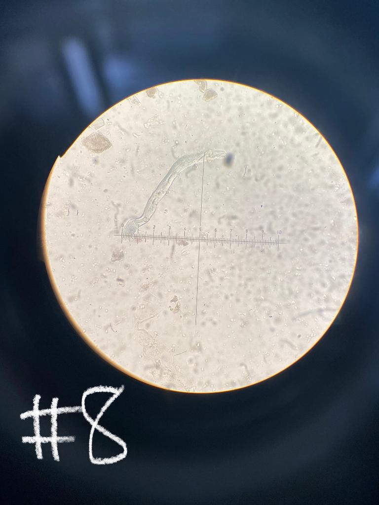 Solved Microscope slide #7 Smear of feces, ordered | Chegg.com