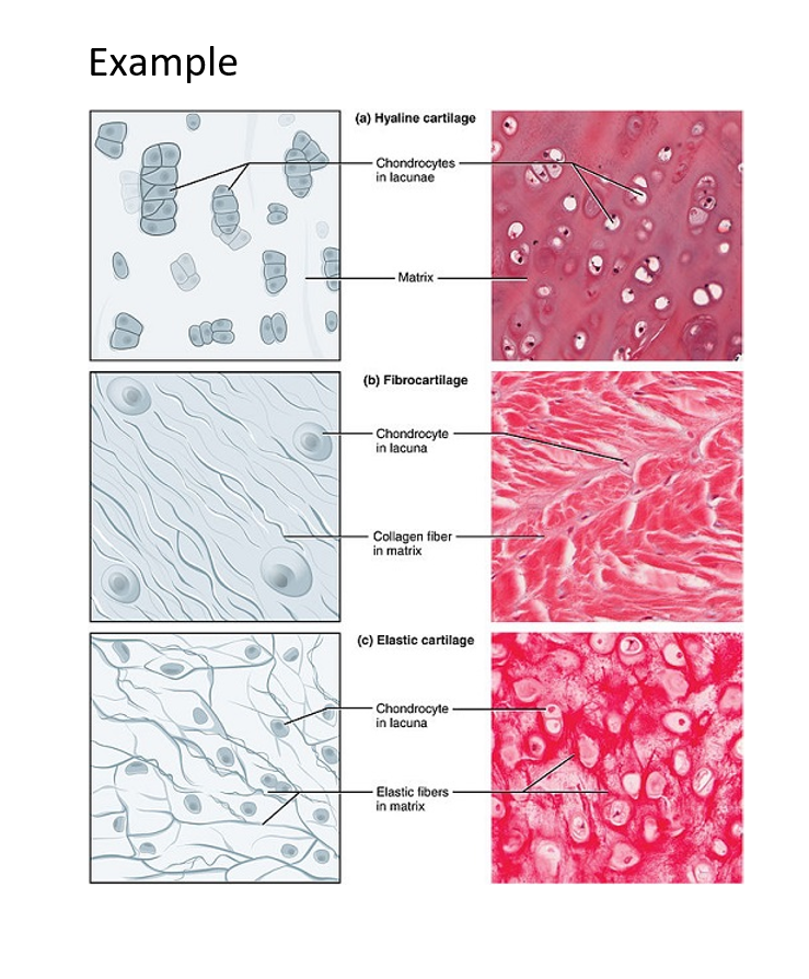 Solved 1) Identify and name the 3 types of cartilage | Chegg.com