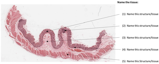 Solved Name the tissue: Name this structure/tissue Name this | Chegg.com