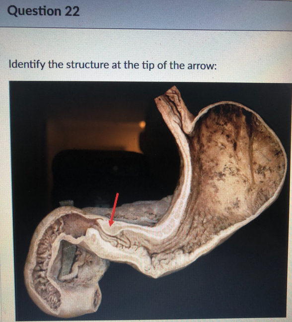 Solved Question 22 Identify the structure at the tip of the | Chegg.com