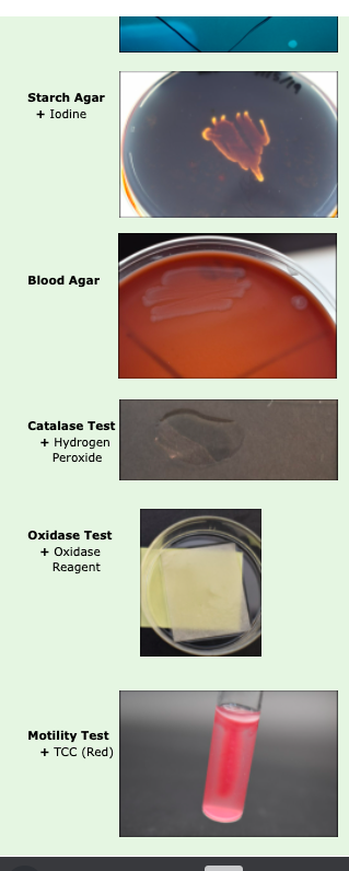 Solved Starch Agar + Iodine Blood Agar Catalase Test + | Chegg.com