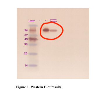 Solved Western Blot Can you help interpret these results | Chegg.com