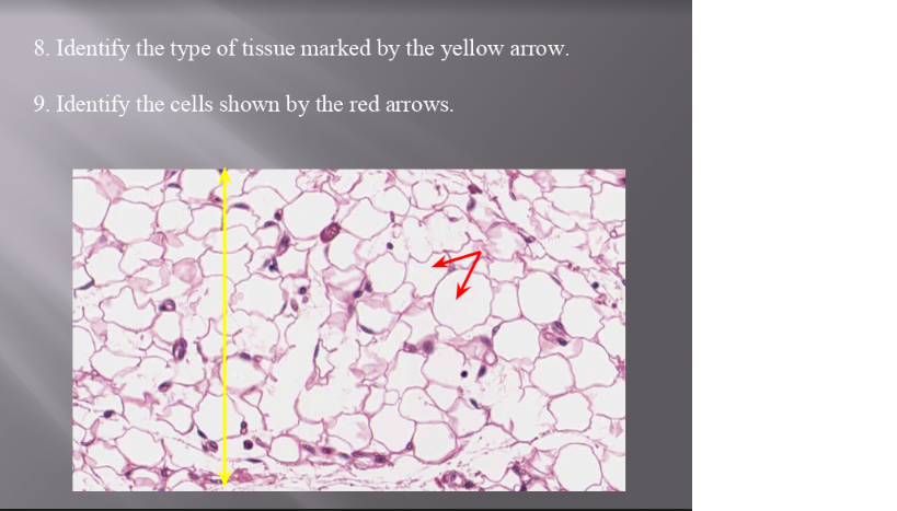 Solved 8. Identify the type of tissue marked by the yellow | Chegg.com