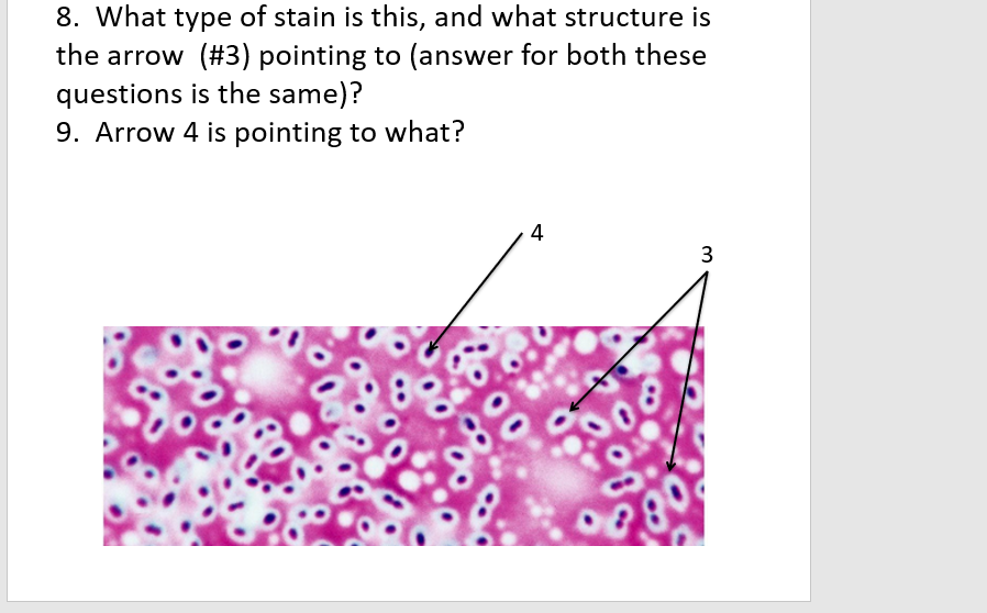 Solved 8. What type of stain is this, and what structure is | Chegg.com