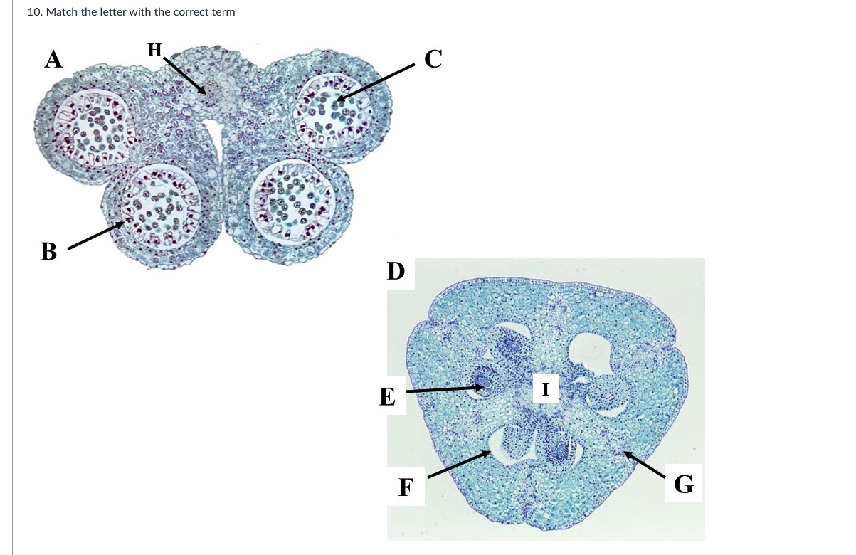 Lily Ovary Cross Section Labeled