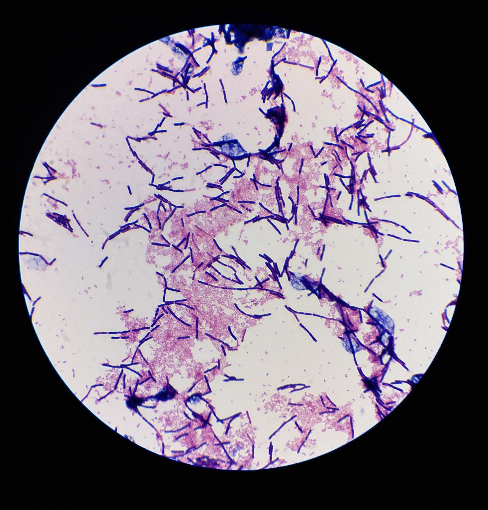 Lactobacillus Plantarum Gram Stain