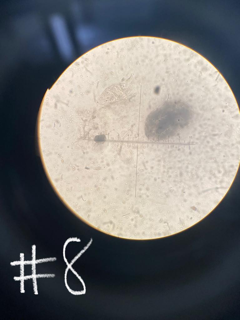 Solved Microscope slide #8 Fecal smear – unspecified stain | Chegg.com