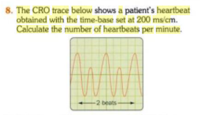 Solved The CRO trace below shows a patient's heartbeat | Chegg.com