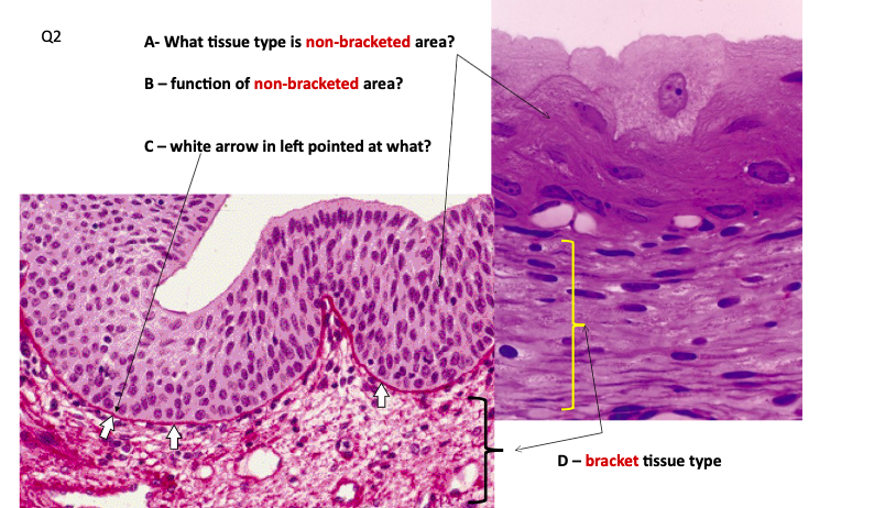 Solved Q2 A- What tissue type is non-bracketed area? | Chegg.com