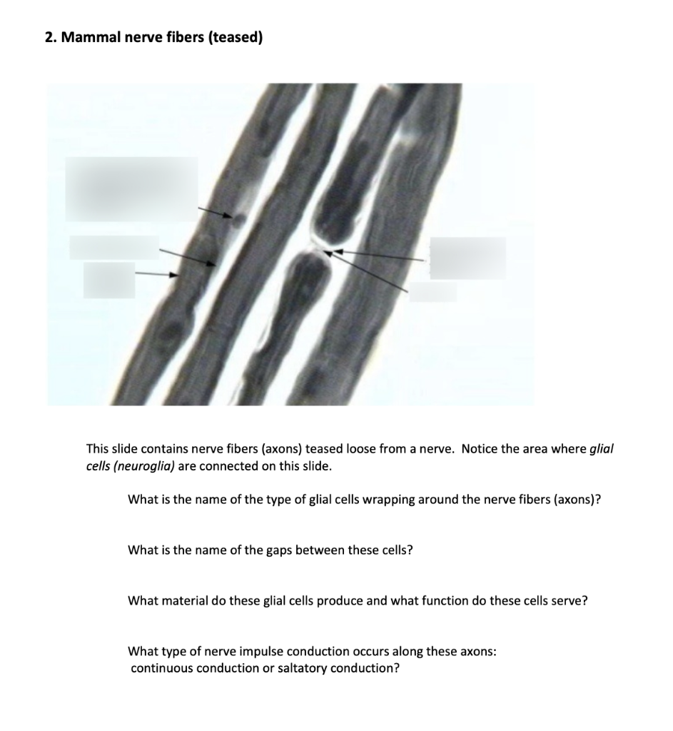 Teased Myelinated Nerve Fiber Slide