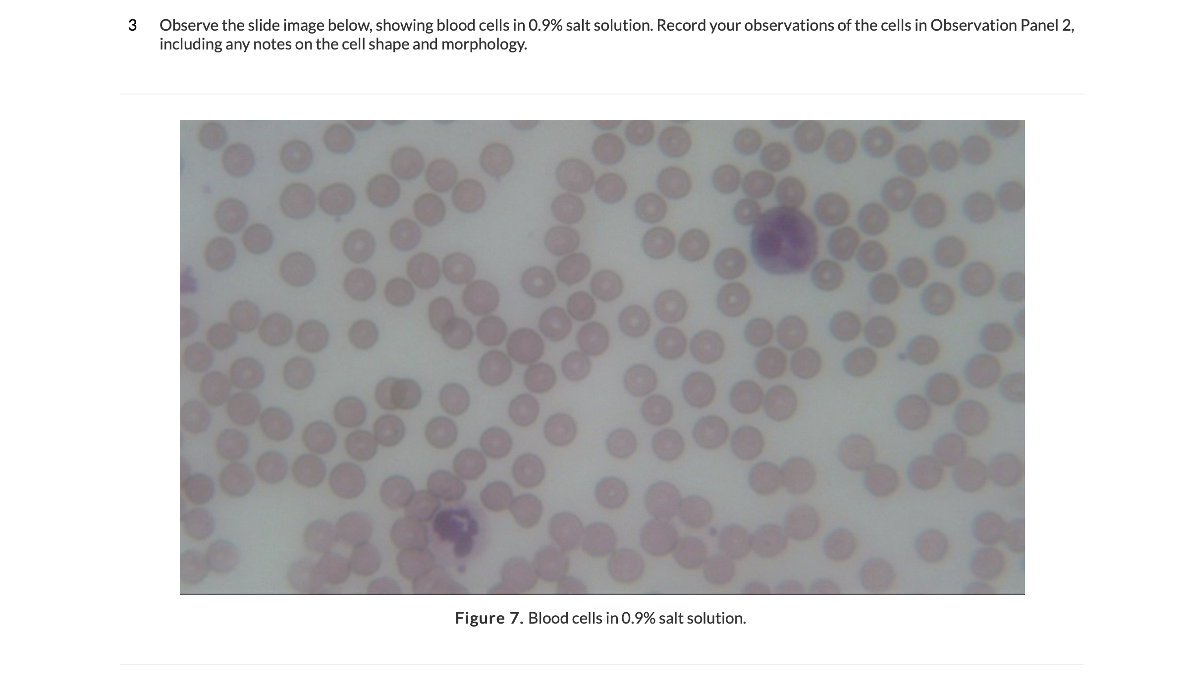 Solved Exercise 1 Observation of Osmosis in Red Blood Cells | Chegg.com