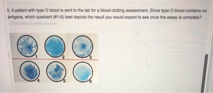Solved 5. A patient with type O blood is sent to the lab for | Chegg.com