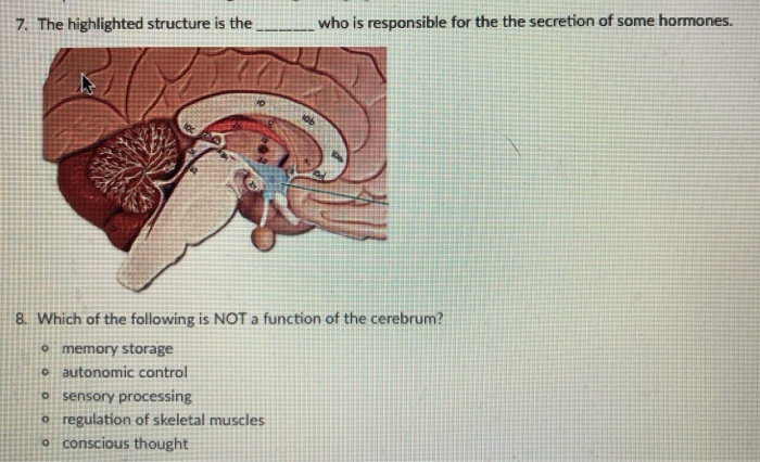 Solved 7. The highlighted structure is the who is | Chegg.com
