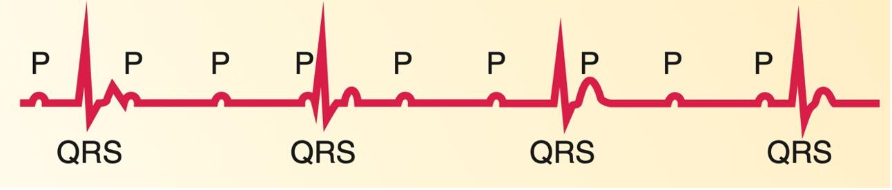 Solved P P P P P P P P P لئنلنننننل QRS QRS QRS QRS | Chegg.com