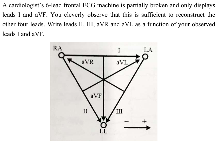 Solved A cardiologist's 6-lead frontal ECG machine is | Chegg.com