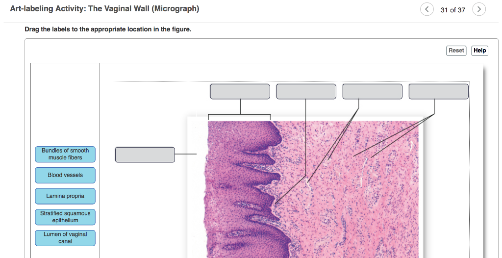 Solved Art-labeling Activity: The Vaginal Wall (Micrograph) | Chegg.com