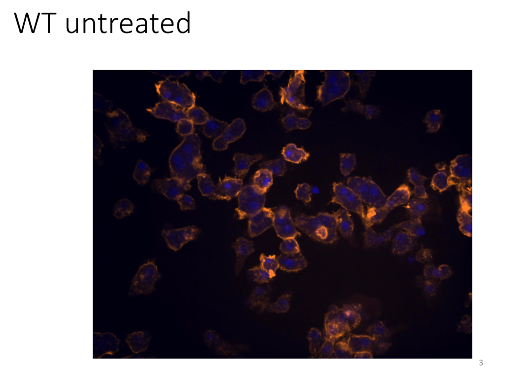 Solved Following is the picture showing actin and DAPI | Chegg.com