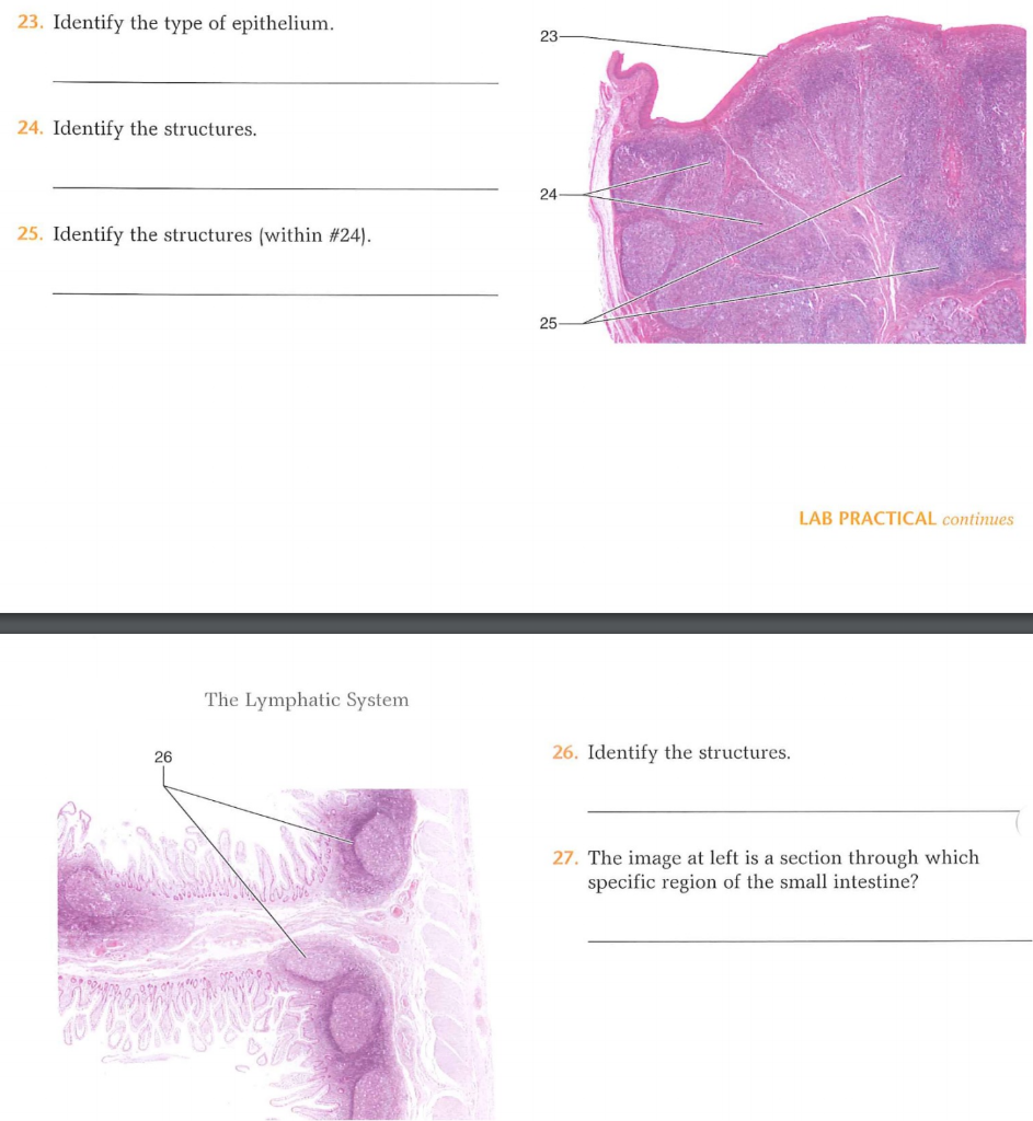 Solved 23. Identify the type of epithelium. 23 24. Identify | Chegg.com