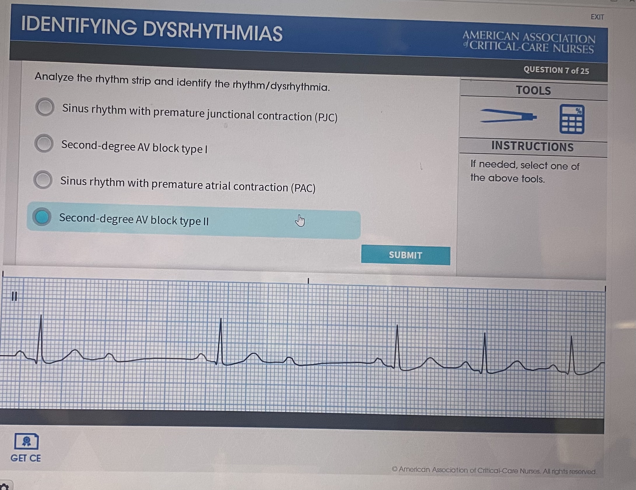 Premature Atrial Contraction Rhythm Strip
