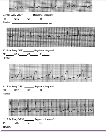 Solved 9. P for Every QRS? PR QRS Rhythm Regular or | Chegg.com
