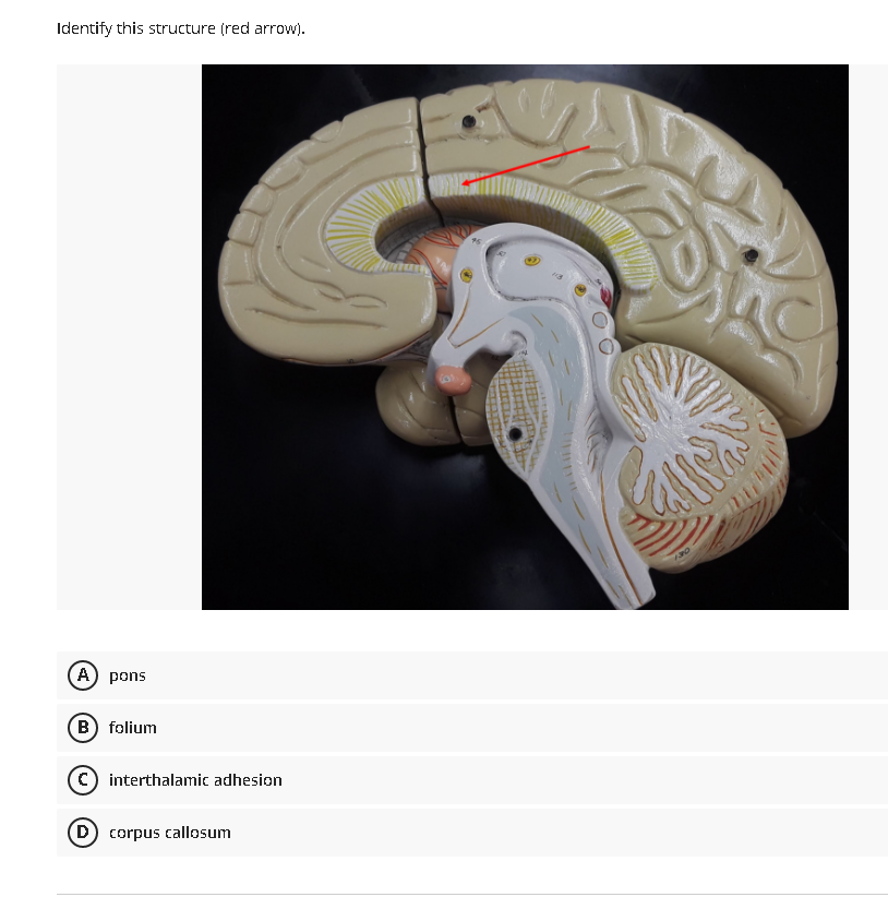 Solved Identify this structure (red arrow). A pons B folium | Chegg.com