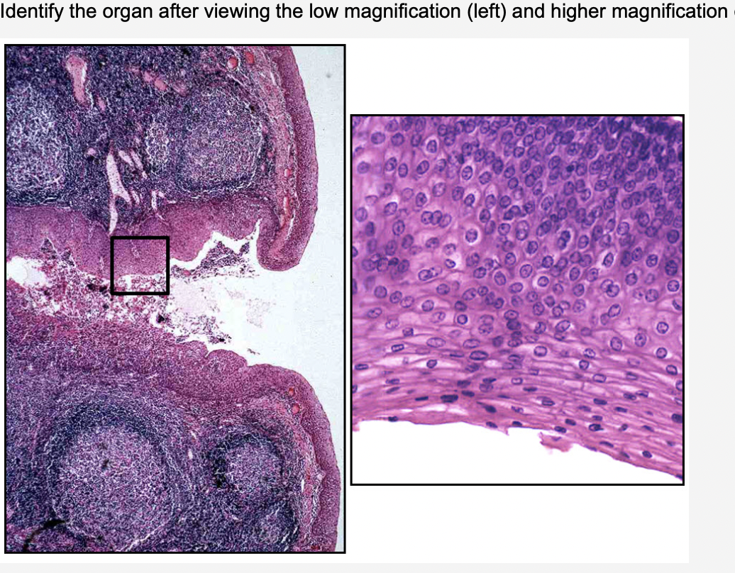 Solved Identify the organ after viewing the low | Chegg.com