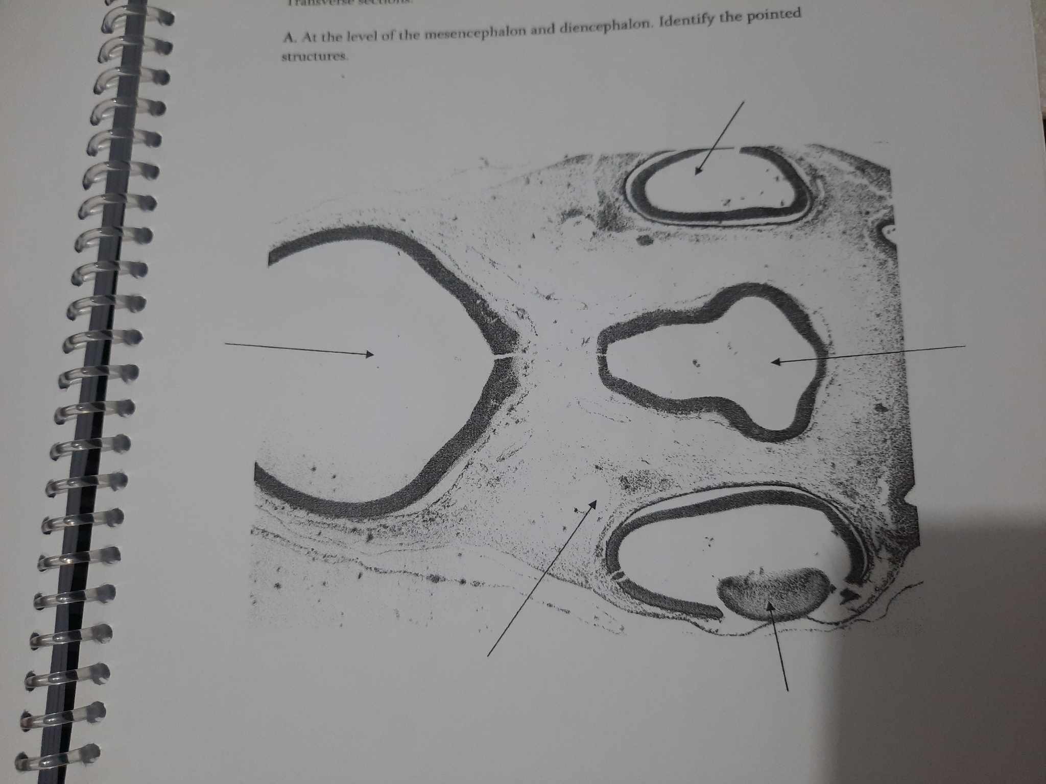 Solved 71 Label the whole mount diagram of the 96-hour chick | Chegg.com