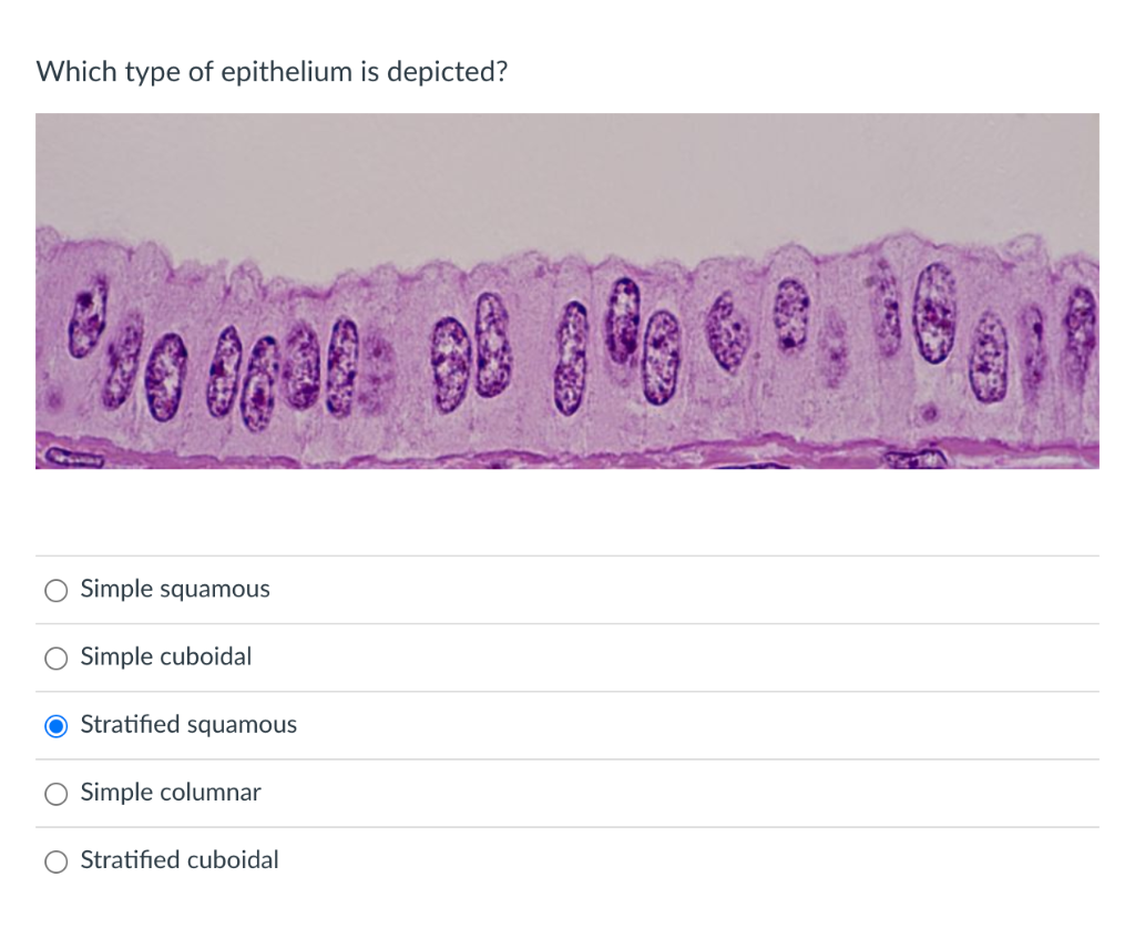 Solved Which type of epithelium is depicted? Simple squamous | Chegg.com